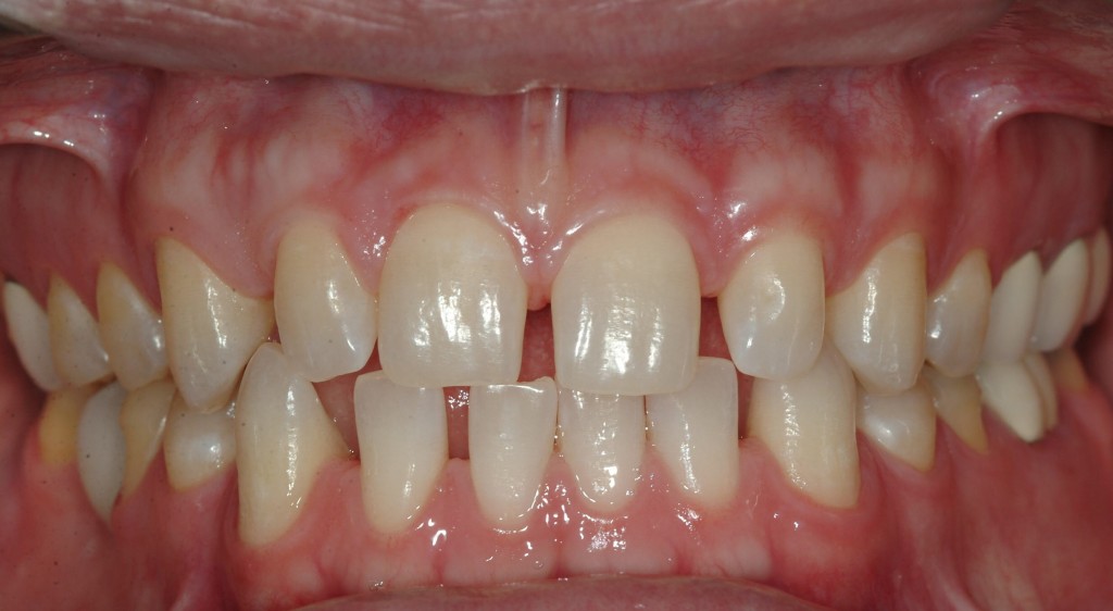 What is orthodontics ? – Uttam Dental Clinic